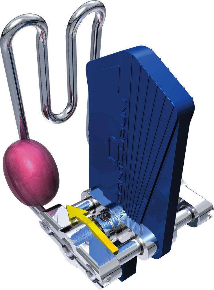 Brazo elástico para doble placa protrusiva según Schaneng con tornillo ...